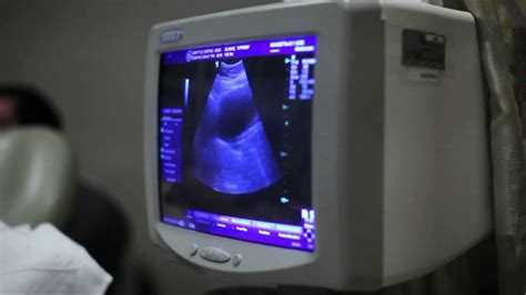 ¿en Qué Consiste Ser Una Madre Subrogada Y Cómo Se Lleva A Cabo La Subrogación Gestacional