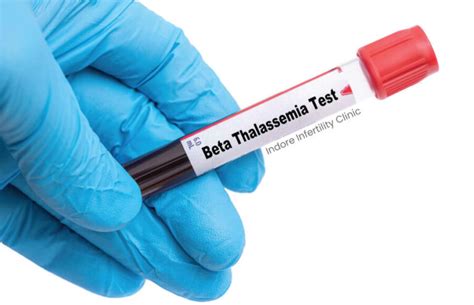 Thalassemia What You Should Know Before Planning Pregnancy