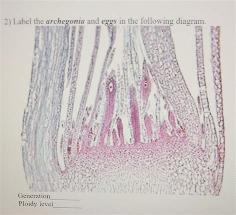 Solved 2 Label The Archegonia And Eggs In The Following