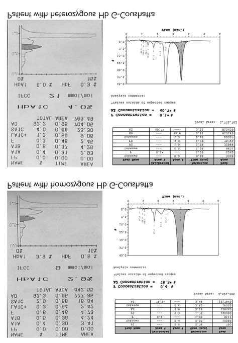 Ion Exchange HPLC Chromatogram For HbA1c And Hb Variants Analysis Of Download Scientific