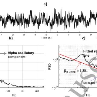 A 10 Seconds Of An EEG Signal From A Healthy Volunteer Acquired At