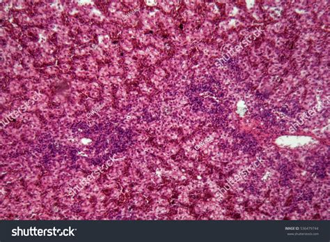Human Liver Cells Under Microscope