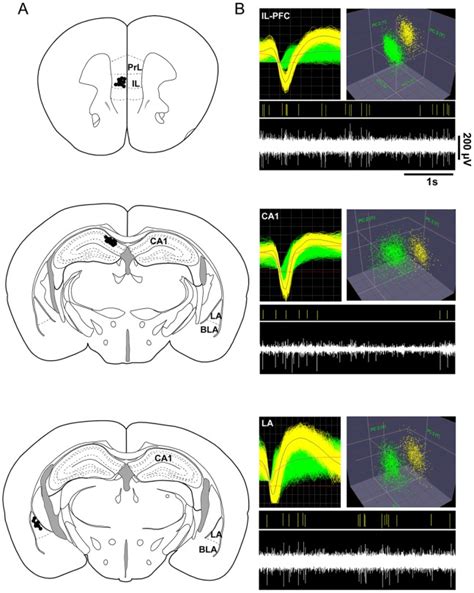 A Schematic Representation Of Electrode Locations In The Infralimbic