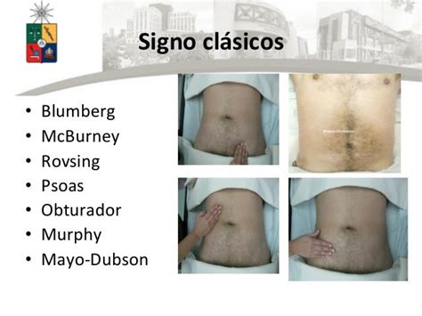 Abdomen Agudo