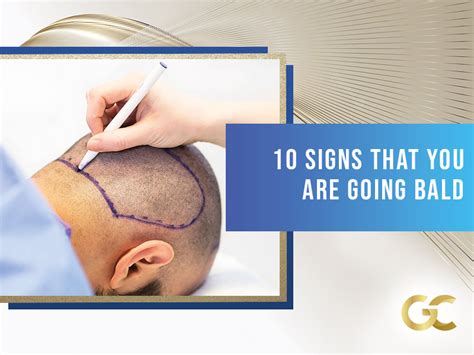 Signs You Are Going Bald Acıbadem Best Hair Transplant Turkey