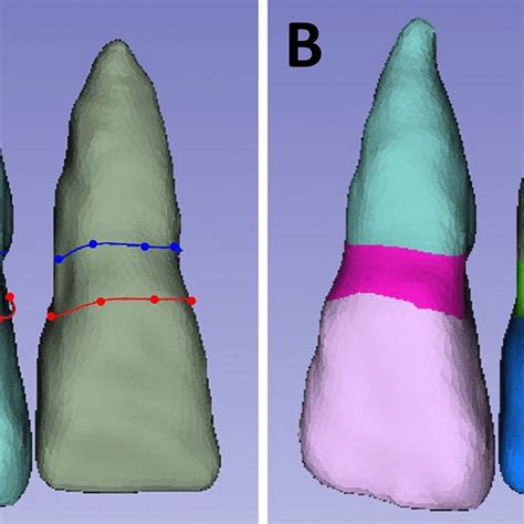 Polygonal Annotation Of The Dataset A Detection Of The Annotated