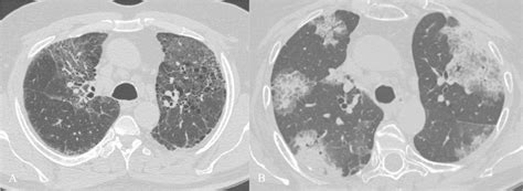 Pattern Inconsistent With Uip Inconsistent With Uip Patterns In Download Scientific