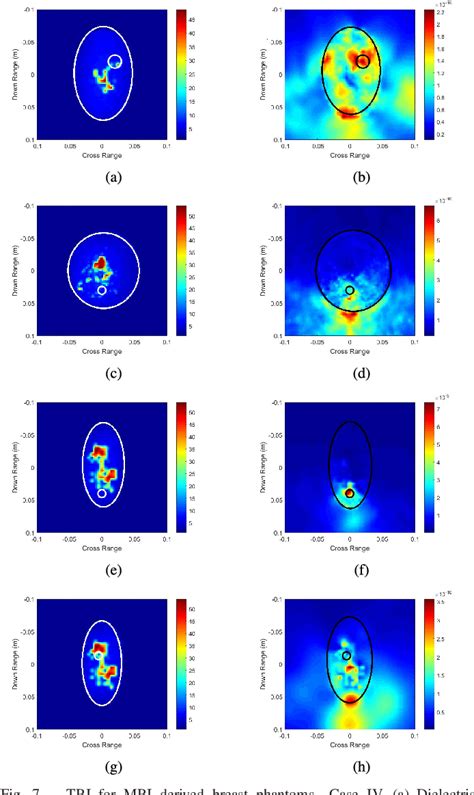 Figure 1 From A Time Reversal Based Microwave Imaging System For Detection Of Breast Tumors