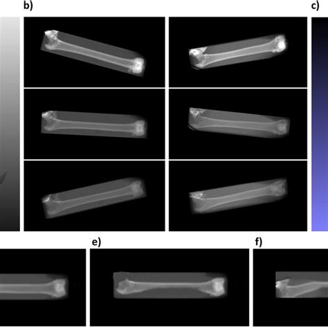 dataset a 3d ct dicom file b examples of x ray images artificially