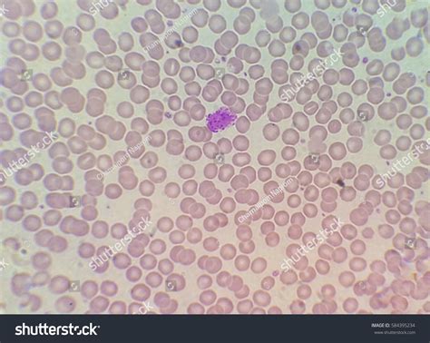Basophil Under Microscope Granulocytes