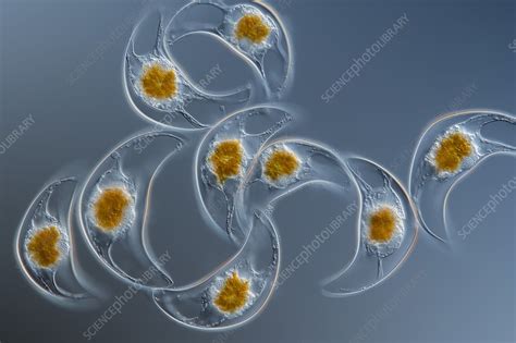 Pyrocystis Lunula Algae Light Micrograph Stock Image C057 7941 Science Photo Library