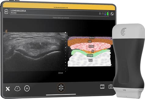 Clarius Portable Handheld Wireless Ultrasound For Point Of Care