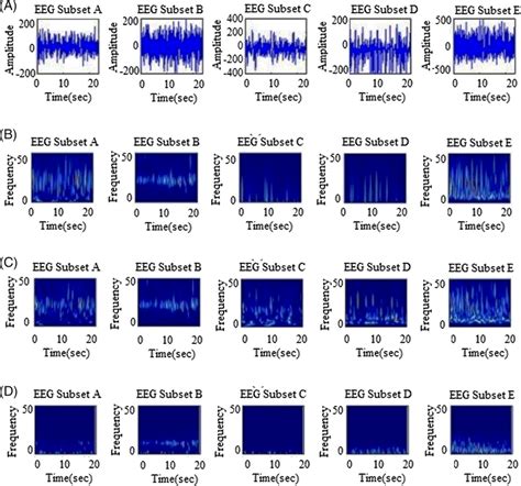 A Electroencephalogram Eeg Segments Of All Sets B Optimized