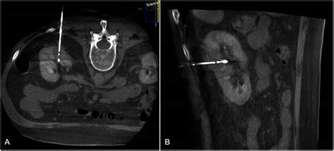 Cone Beam Computed Tomography Image Fusion With Cross Sectional Images