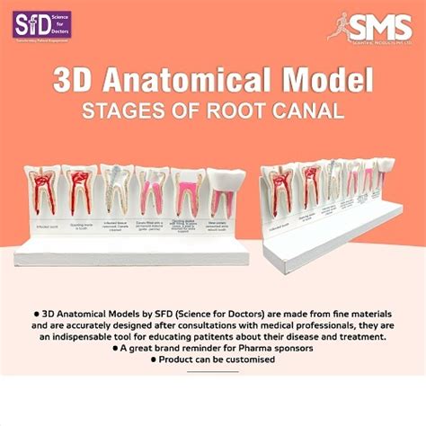 3d Anatomical Model Stages Of Root Canel At Best Price In Mumbai