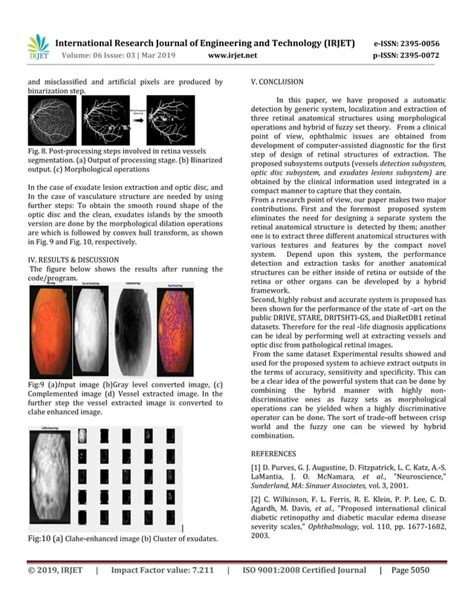 Irjet Retinal Structure Segmentation Using Adaptive Fuzzy Thresholding