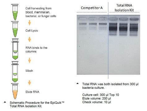 总RNA提取试剂盒 适用于血液细胞细菌真菌 满足您所需 每日生物评论