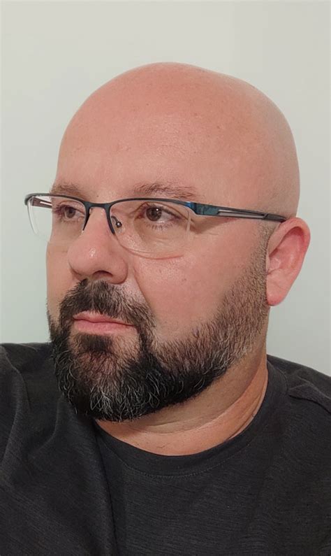 Д р Звездан Милески Хирург Мамолог Пловдив Хасково Супердок