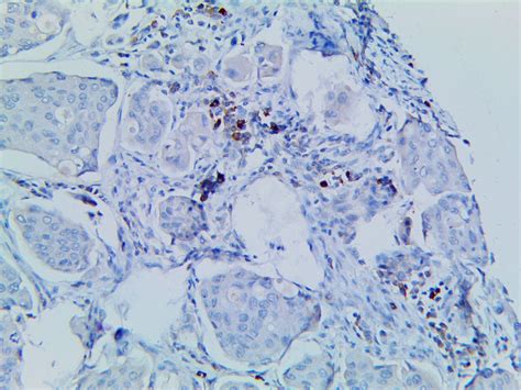 Mum1 Antibody Ep190 Bio Sb