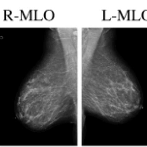 Breastcancerclassifier Kaggle