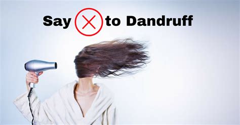 How To Get Rid Of Dandruff Naturally