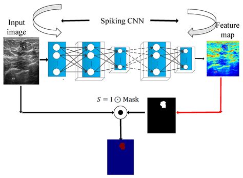 Spiking Neural Network Based On Multi Scale Saliency Fusion For Breast Cancer Detection