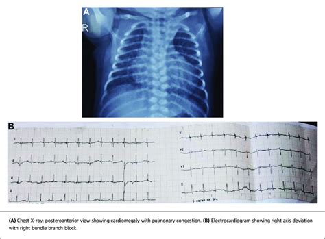 Preoperative Investigations Download Scientific Diagram