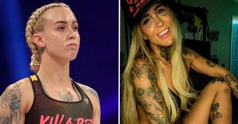 Bare Knuckle Boxer Shows Off Her Brutal Black Eyes While Posing In Tiny