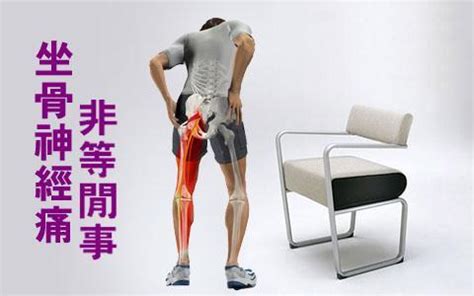 坐骨神經痛對百姓的危害應早認識 每日頭條