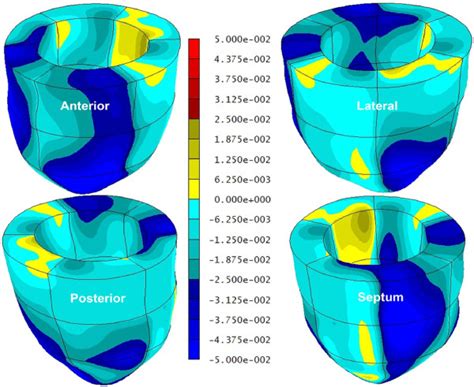 Circumferential Strain Contour Plots In Men And Women This Left
