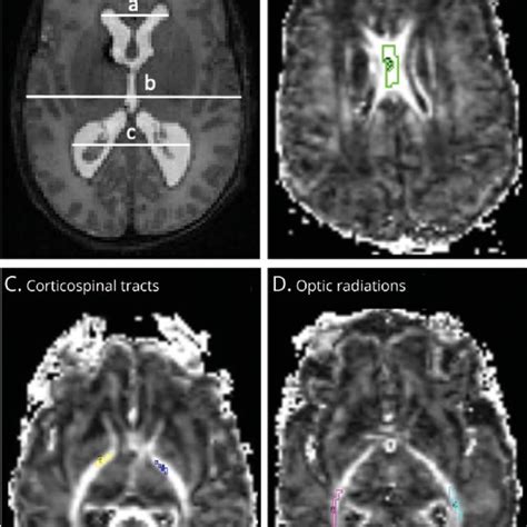Representative Diffusion MRI Download Scientific Diagram