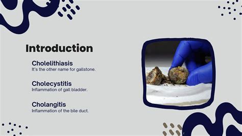 Gallstones Cholelithiasis Lifestyle Risk Factors Preventions Pdf