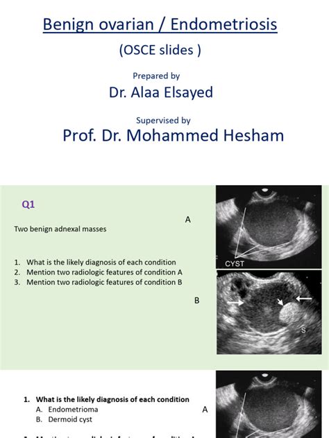 Endometriosis Osce Slides Pdf Genitourinary System Diseases Medical Specialties