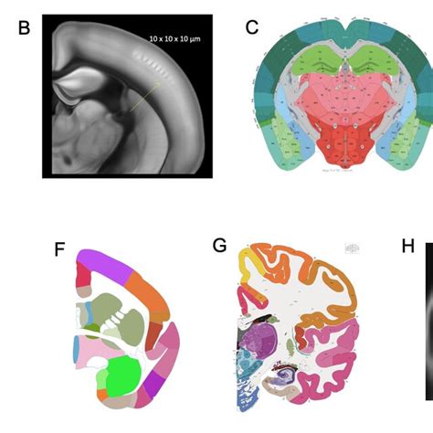 Common Coordinate Frameworks Of The Brain A B Allen Mouse Brain Download Scientific Diagram