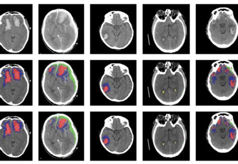 Different Types Of Scans