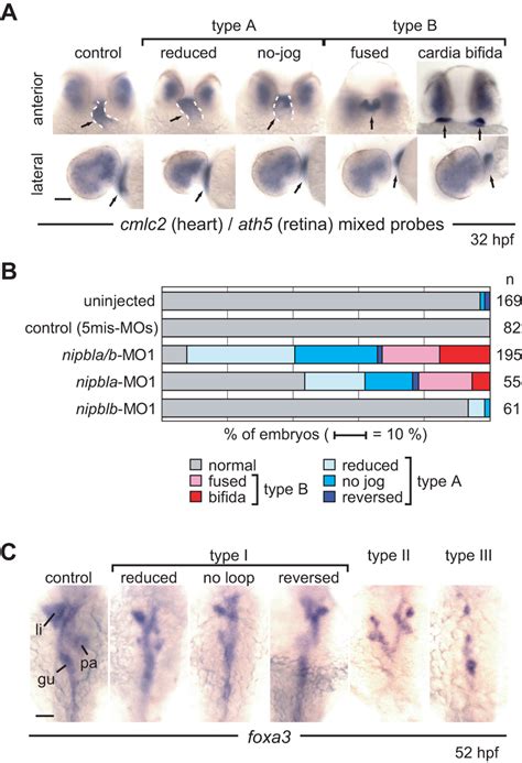 Effects Of Nipbl Mos On Heart And Gut Development A Heart Morphology