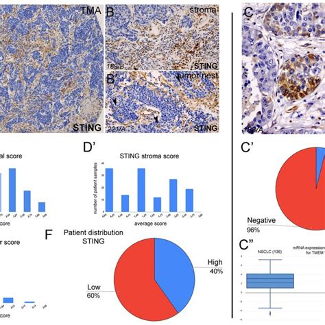 Sting Immune Checkpoint Protein Expression In Sclc Panel A B Shows