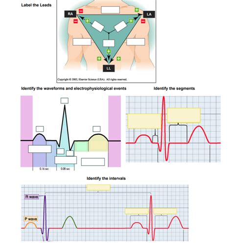 Ecg Diagrams Diagram Quizlet