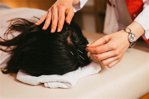 Acupuncture For Fertility Points Benefits Efficacy And More