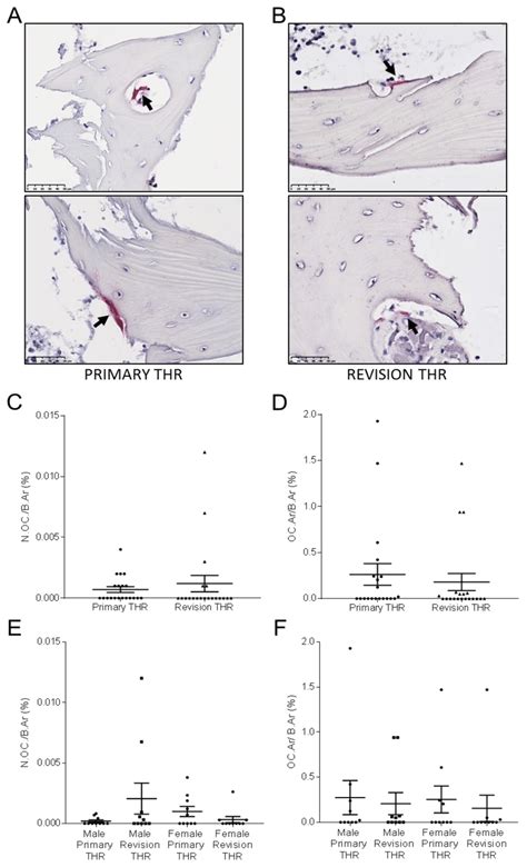 Bone Biopsies Were Obtained From Primary Thr A And Revision Thr Download Scientific Diagram