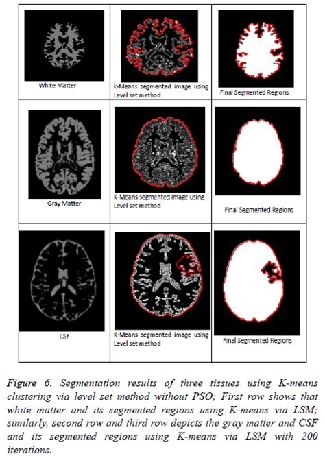 A Review On Optimized K Means And Fcm Cl Biomedical Research