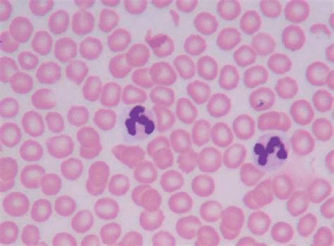 What Does High Monocytes Mean In Dogs
