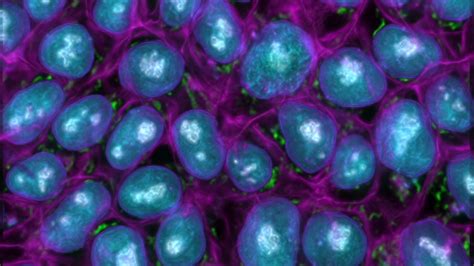 Longevity And The Aging Extracellular Matrix Gowing Life