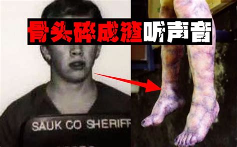 骨裂癖把全身骨头敲碎听声音满足迷之癖好 哔哩哔哩