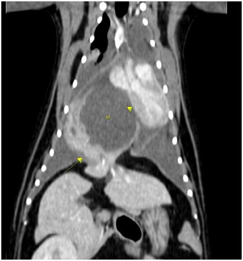Severe Pericardial Effusion In A Cat With Peritoneopericardial Diaphragmatic Hernia And
