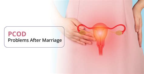 Types Of Pcod Problems In Female After Marriage Birla Fertility And Ivf