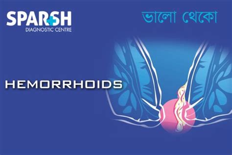 Understanding Hemorrhoid Grades Sparsh Diagnostic Center