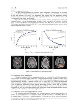 A Deep Learning Approach For Brain Tumor Detection Using Magnetic Resonance Imaging DeepAI