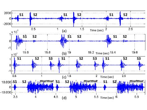 Several Examples Of Pcg Recording Show The Unique Pcg Pattern For Each Download Scientific