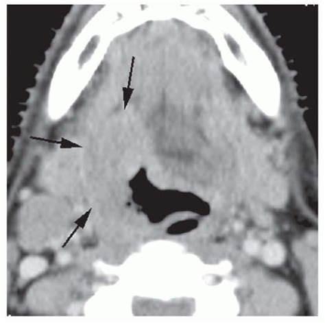 Radiologic Imaging Concerns Oncohema Key